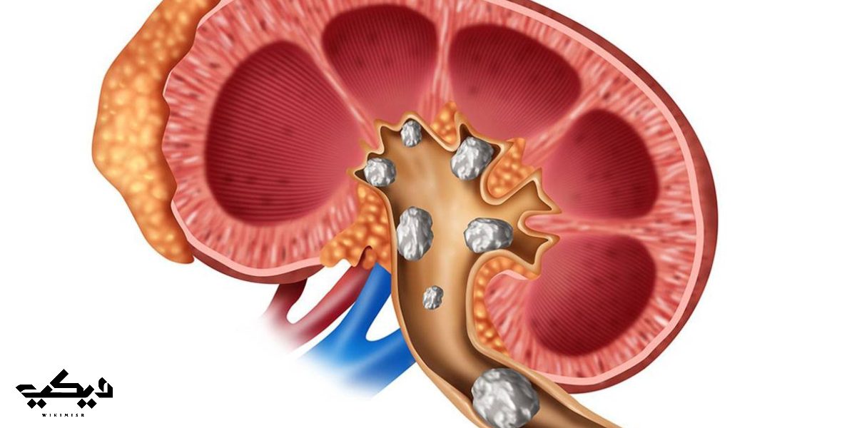 دواء flopadex لعلاج البروستاتا وآثاره الجانبية | ويكي مصر