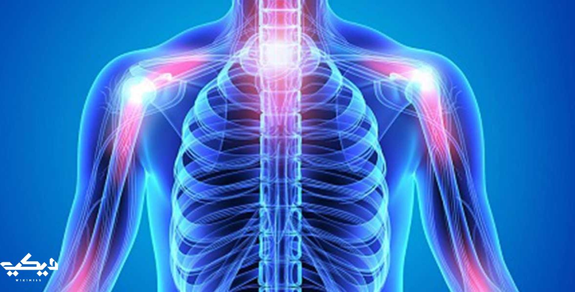 أقراص Arthfree لعلاج التهاب المفاصل ومسكن للآلام | ويكي مصر