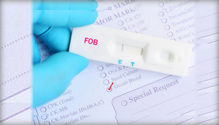 ما هو اختبار FOBT؟ | ويكي مصر